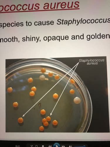 Staphylococcus Flashcards Quizlet Staphylococcus Flashcards Quizlet