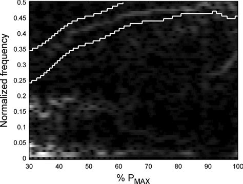 Spectrogram Of R R Interval Series During Exercise Example Is Shown Of