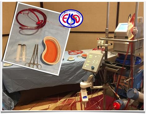 Velia Marta Antonini On Linkedin Ecmo Simulations Laelso18 Ecls
