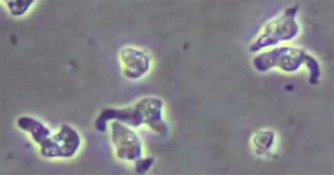 Brain Eating Amoeba Death In Georgia Cbs News