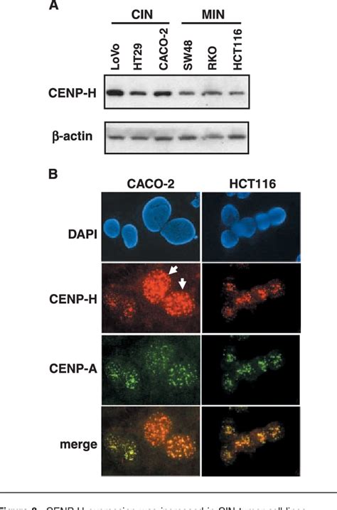 Figure 1 From Centromere Protein H Is Up Regulated In Primary Human Colorectal Cancer And Its
