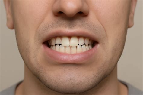 What Your Bite Says About Your Health Lema