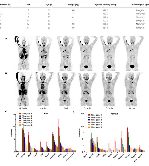 Table 1 From Dynamic Petct Imaging Of 68ga Fapi 04 In Chinese Subjects