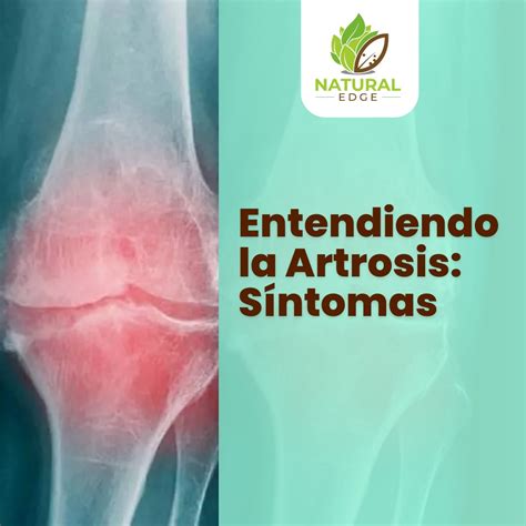 Natural Edge ¡natural Edge Al Rescate 🌿 Comprender Los