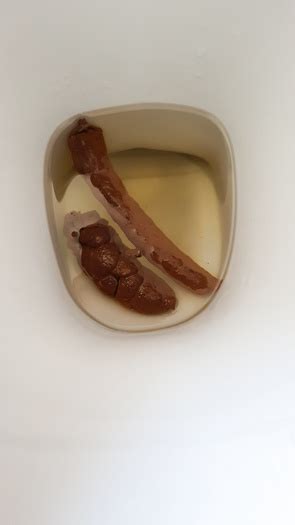 Long Poo Image 3618427 Thisvid Tube