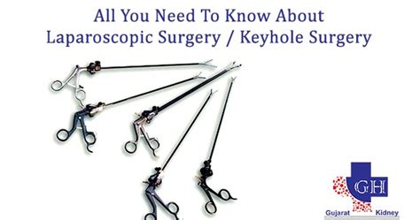 All You Need To Know About Laparoscopic Surgery Keyhole Surgery