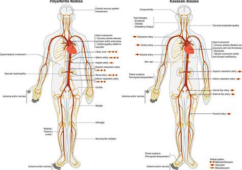 Medium And Large Vessel Vasculitis Circulation