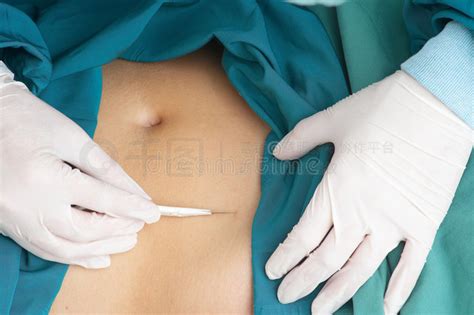 S公司高清图片 手术刀 手术刀图片免费下载 5126371005 千图网pro