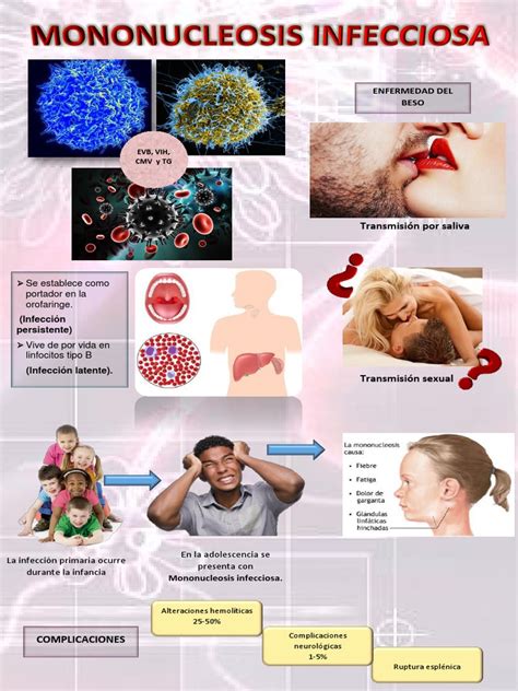 Mononucleosis Infecciosa Pdf