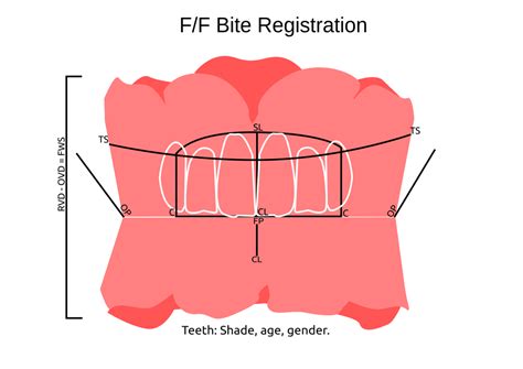 News Bremadent Dental Laboratory