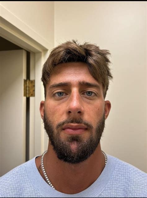 Knot In Masseter Muscle Rtmj