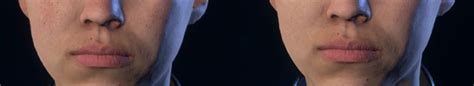 Custom Complexions And Tweaks At Mass Effect Andromeda Nexus Mods And