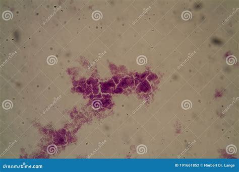Streptococcus Bacteria Streptococcus Species Are Responsible For