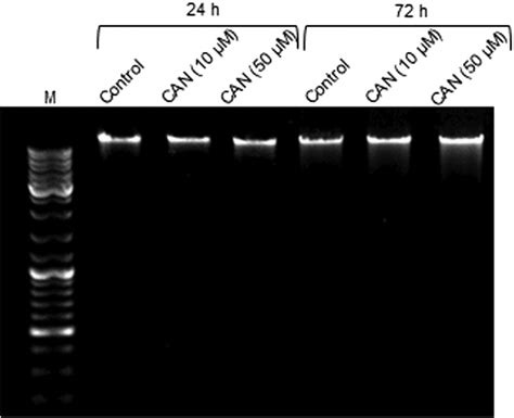Typical Patterns Of Dna Fragmentation Assay Dna Was Isolated From