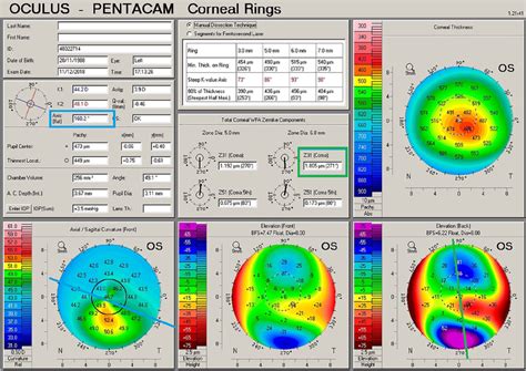 Preoperative Corneal Topography And Coma Wavefront Map Pentacam® Download Scientific Diagram