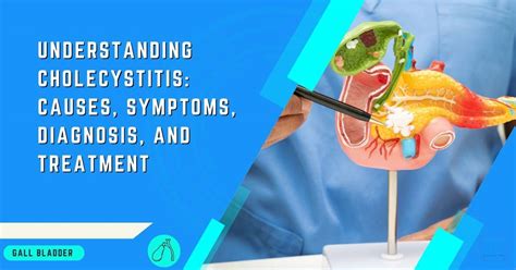 Understanding Cholecystitis Causes Symptoms Diagnosis And Treatment