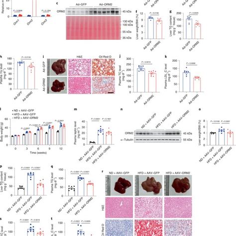 Orm2 Overexpression Alleviates Liver Steatosis And Hyperlipidemia In