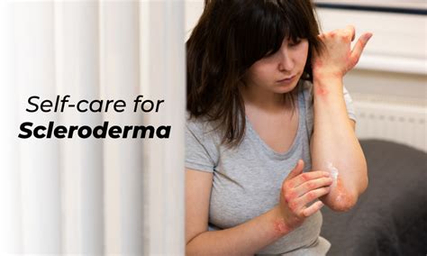 Symptoms Of Scleroderma And Its Self Care