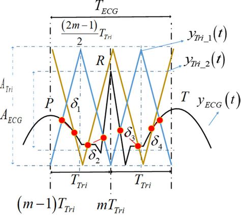 Bipolar Pulse Active Technique Download Scientific Diagram