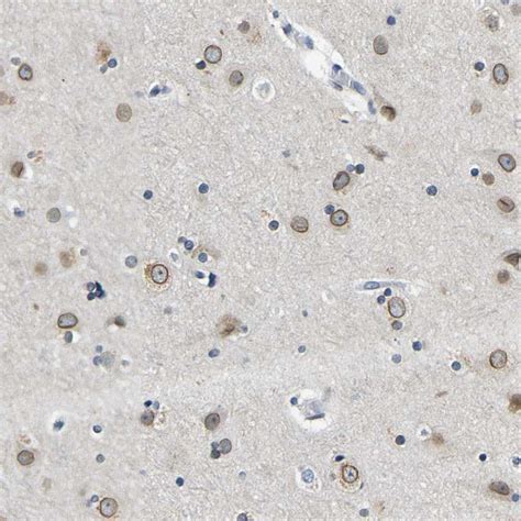 Rabbit Polyclonal Anti Ranbp2 Antibody Buy For Research Highly