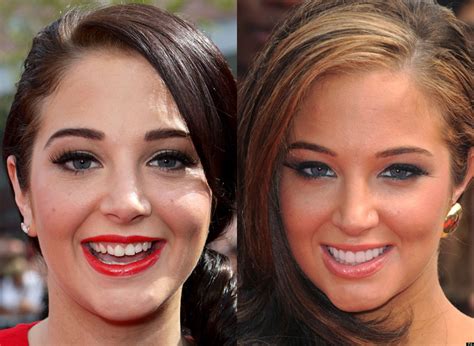 How To Got White Teeth