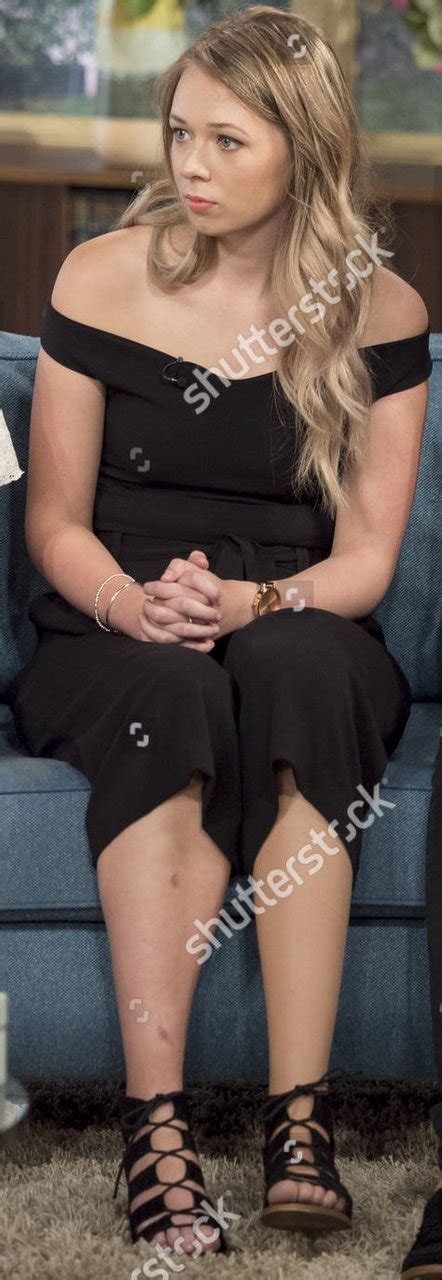 Amputees With Nice Legs