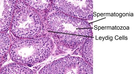 Spermatogenesis Slide Labeled