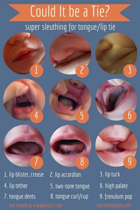 Lip Tongue Ties And Breastfeeding — The Bump