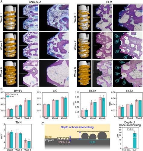 Microscale Bone Interlocking Enhances Osseointegration Strength On The Rough Surface Of 3d