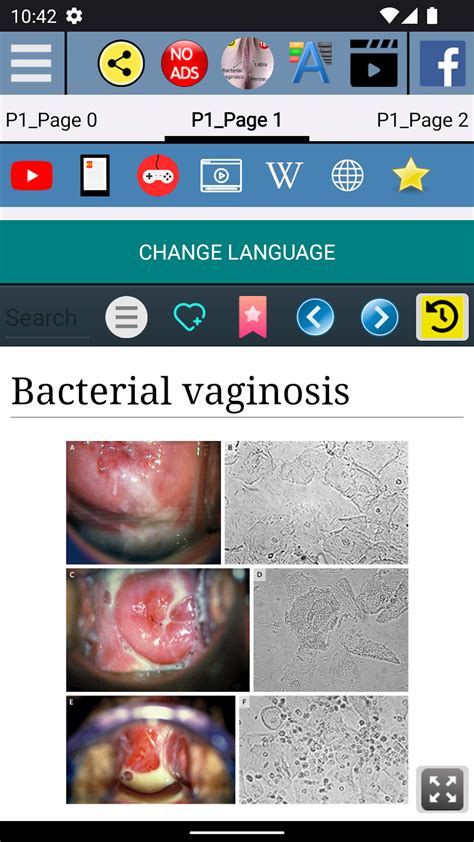 Bacterial Vaginosis Symptoms For Android Download