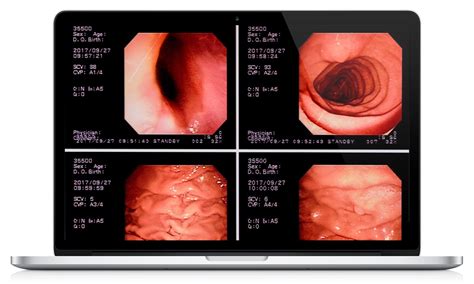 Surgical Intelligence Ai Imerit