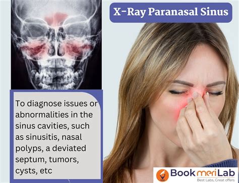 X Ray Pns Price Book Online At Top Radiology Centers