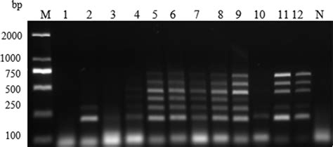 Amplified Products Of The Multiplex Pcr Method During Optimization Of
