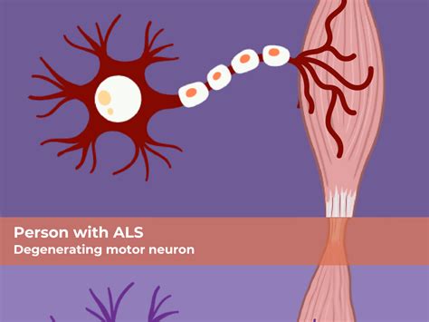 How Does Als Affect The Nervous System