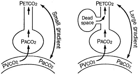 Relationship Between P Aco 2 Alveolar Partial Pressure Of Co 2 P Aco Download Scientific
