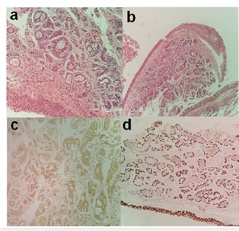 A Evident Biphasic Nature With Ductal Cells Towards The Luminal