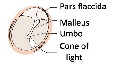 Pars Flaccida Of Tympanic Membrane Alchetron The Free Social