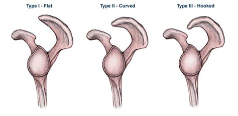 Why Shoulders Have To Move Differently Movement Fix