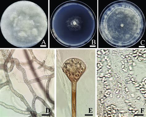 Apophysomyces Thailandensis Sdbr Cmus26 Holotype A Colony On Potato
