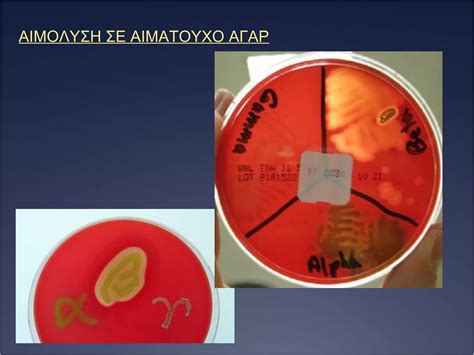 Streptococcus Spp Ppt