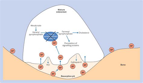 Bisphosphonates The Bmj