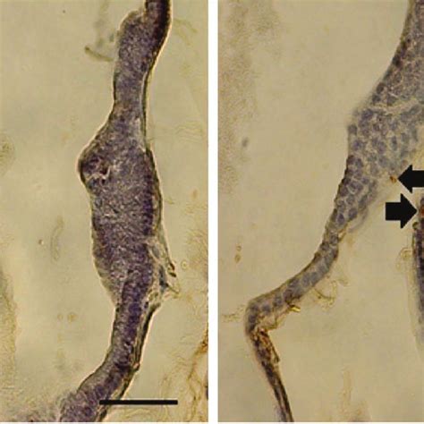 Analysis Of Apoptotic Cells By Tunel Staining ×400 Arrows Indicate