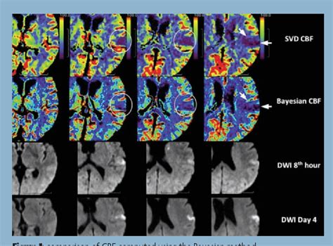 Figure 1 From The Bayesian Method A Widely Applicable Algorithm In Medical Imaging Semantic