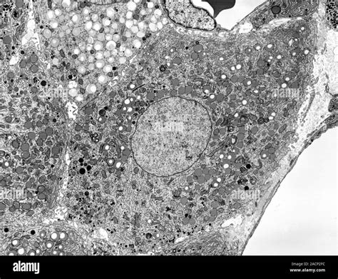 Corpus Luteum Transmission Electron Micrograph Tem Of A Section