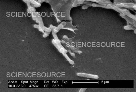Clostridium Difficile Bacteria Under Stock Image Science Source Images