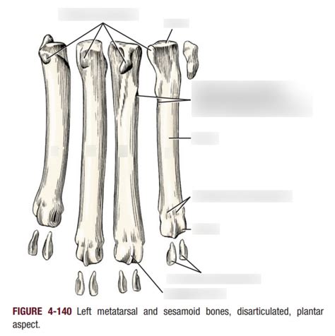 Left Metatarsal And Sesamoid Bones Disarticulated Plantar Aspect