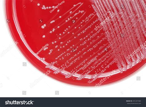 Стоковая фотография 391207384 Gamma Hemolytic No Hemolysis