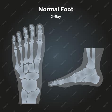 Premium Vector Normal Foot Xray