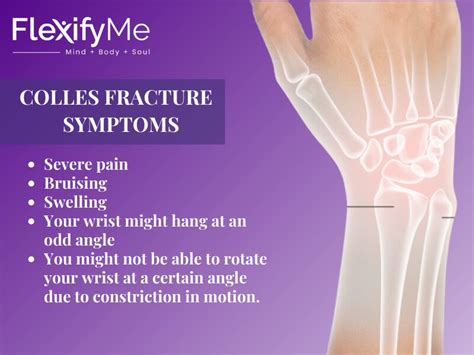 Understanding Colles Fracture Symptoms To Solutions