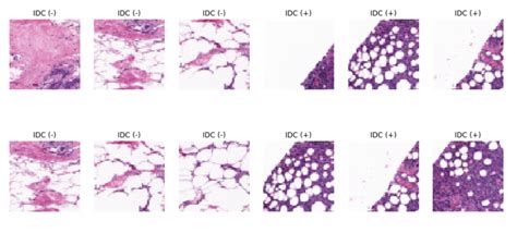 Sample Images From Idc Dataset Download Scientific Diagram